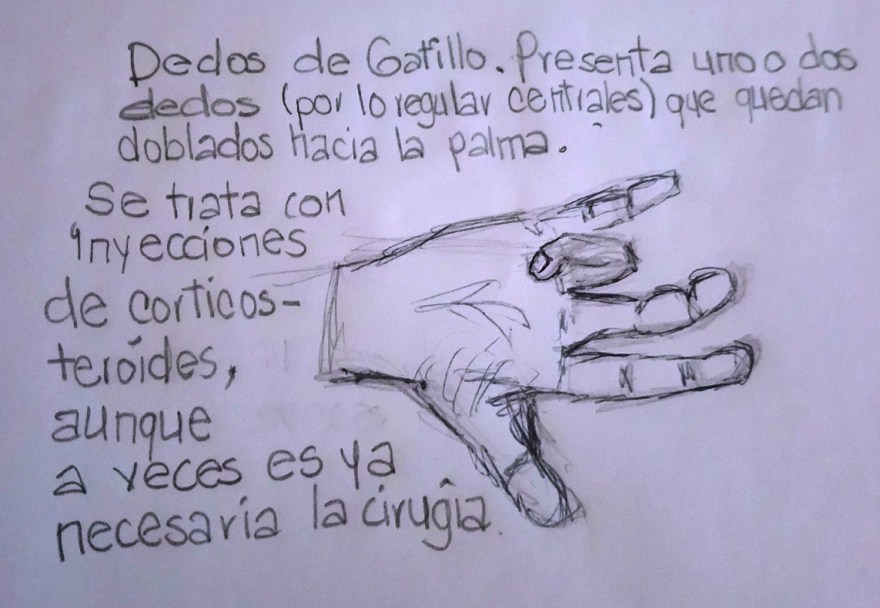 DEFORMACIÓN DE LOS DEDOS. – Belleza Micrón.
